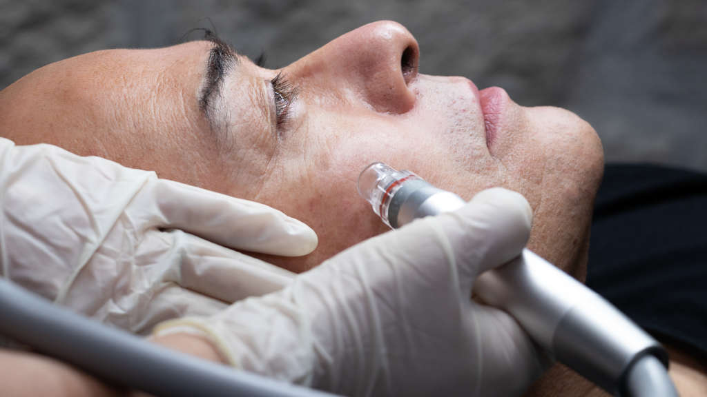 Hyfra Face - Hydra Lift - Maquillage permanent Styliderm